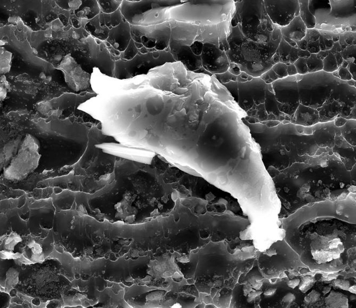Electron Microscope Photos Show Spider Skin Coffee Dandelions Tomato In Extreme Close Up