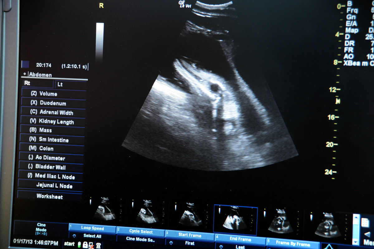 Pregnant Dolphins: Brookfield Zoo Announces 3 Bottlenose Dolphins Are ...