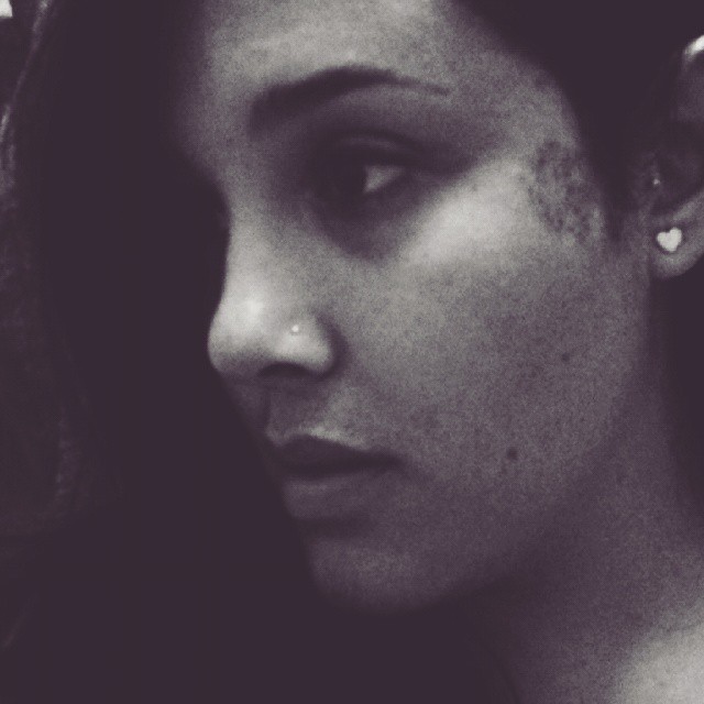 These 19 Stunning Photos Prove That Birthmarks Are Beautiful | HuffPost