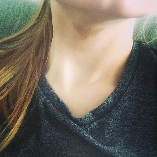 These 19 Stunning Photos Prove That Birthmarks Are Beautiful Huffpost