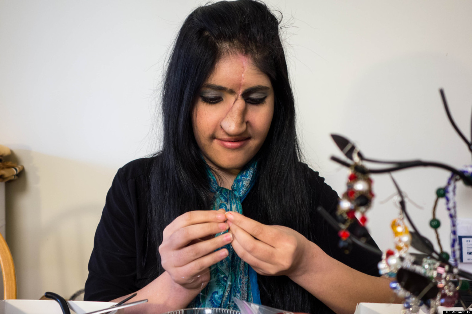 Aesha Mohammadzai Photos: Afghan Woman Who Had Nose, Ears Cut Off By ...