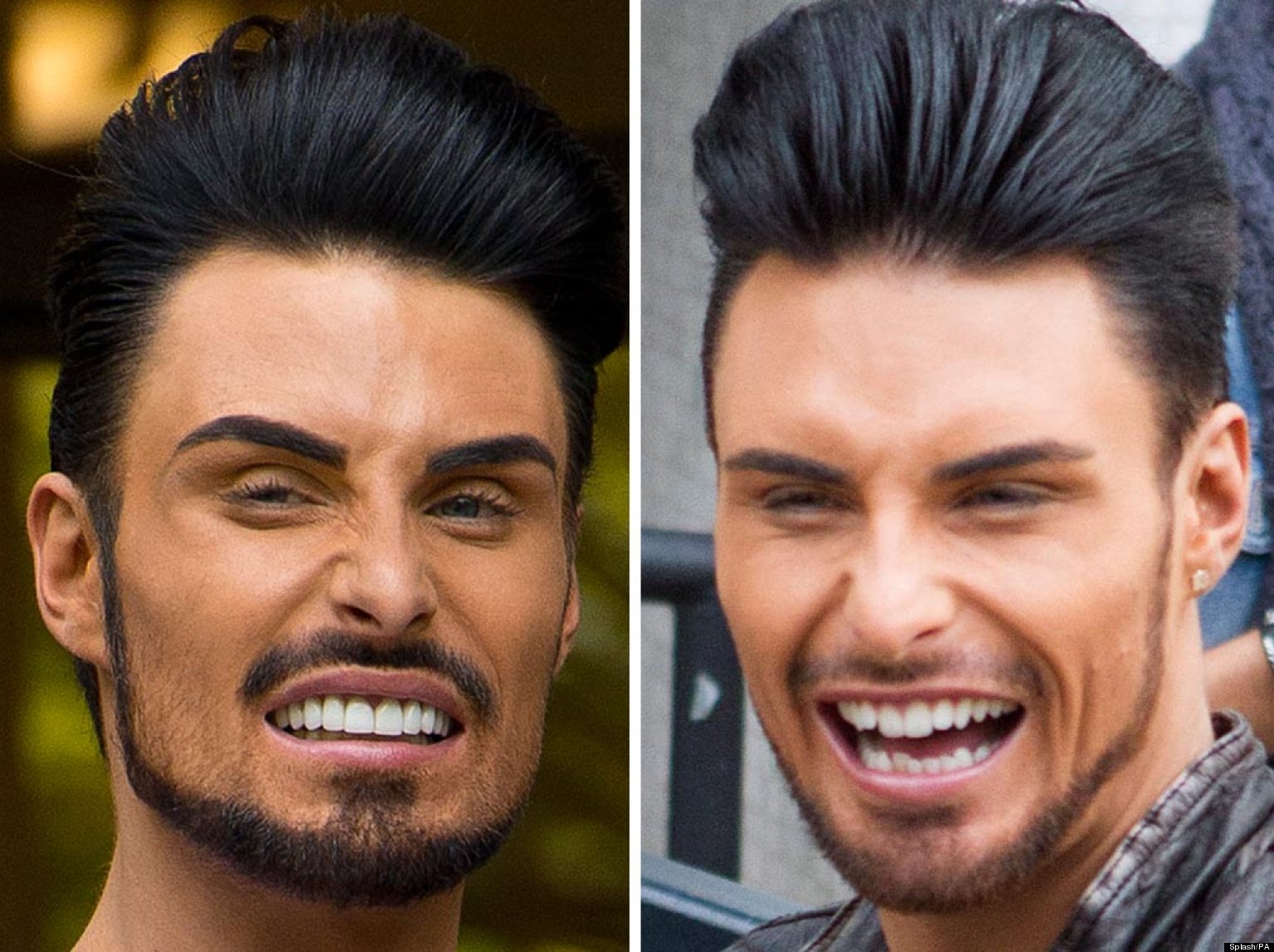 Rylan Clark Debuts New Teeth On 'Big Brother's Bit On The Side ...