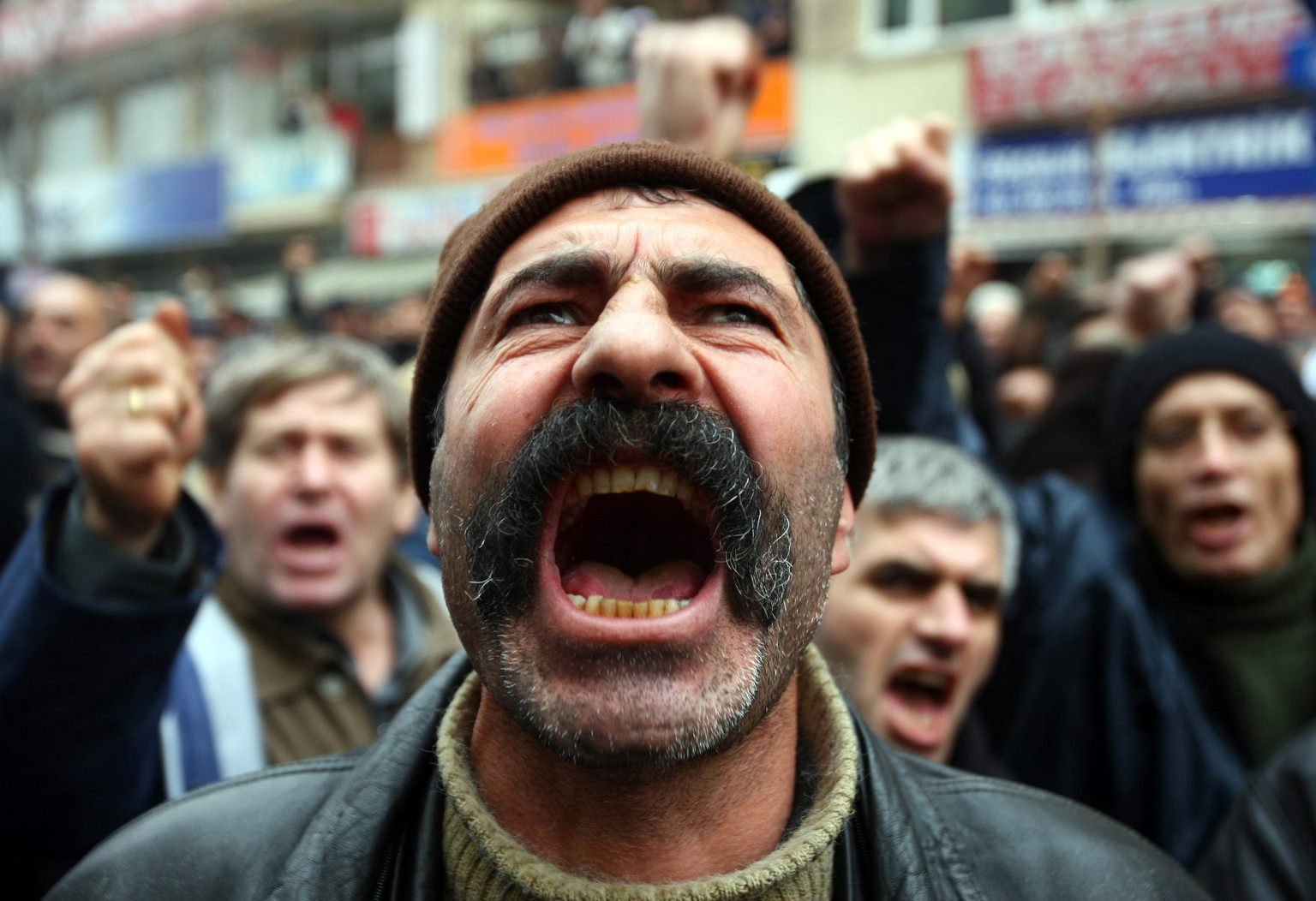 Mustache Transplants New Cosmetic Craze In Turkey (VIDEO) | HuffPost