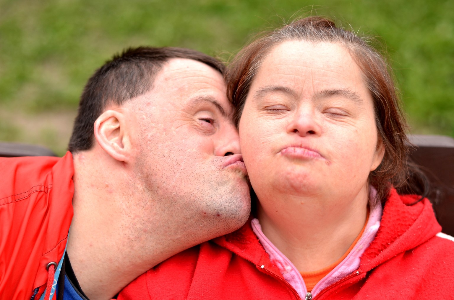 Down Syndrome Treatment Study Shows Experimental Drug Reverses Down Syndrome Treatment Study Shows Experimental Drug Reverses