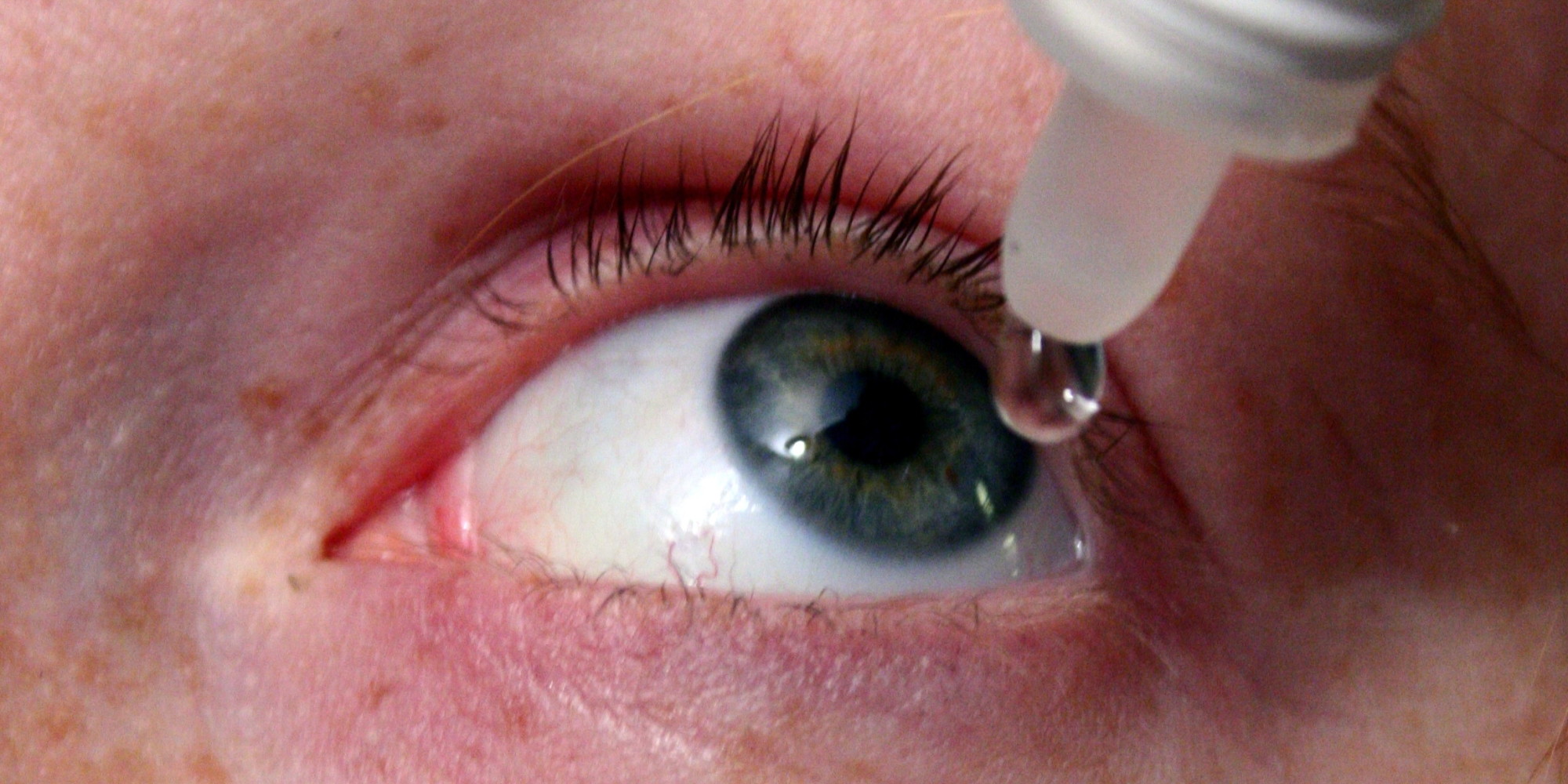 Eye Drops Could Treat Age Related Macular Degeneration HuffPost eye-drops-could-treat-age-related-macular-degeneration-huffpost
