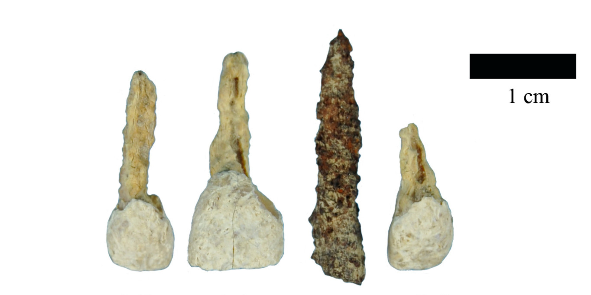 Dental Implant Discovery Suggests Ancient Celts May Have Sported ...