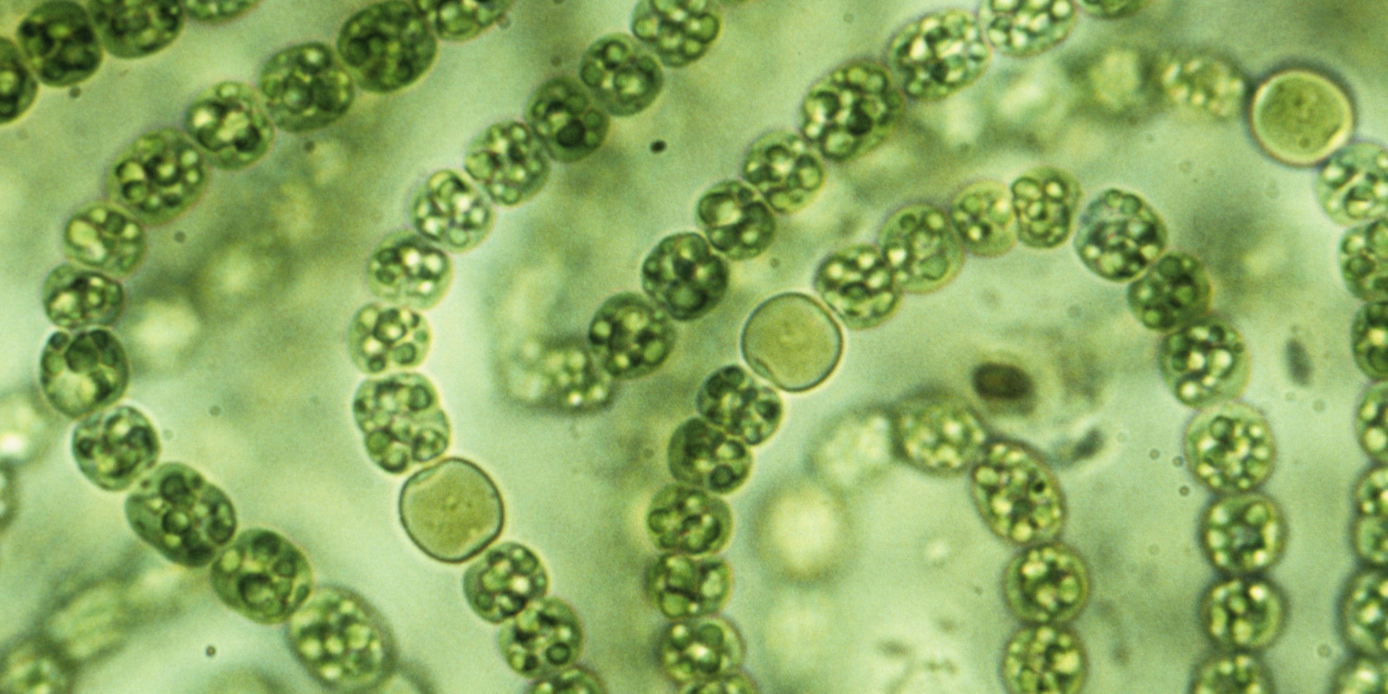 Bacteria Evolved to Save the Planet. Can We? | HuffPost