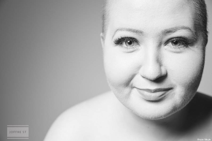 Cancro al seno, le foto di Allison Snare, 24 anni, dopo la doppia ...