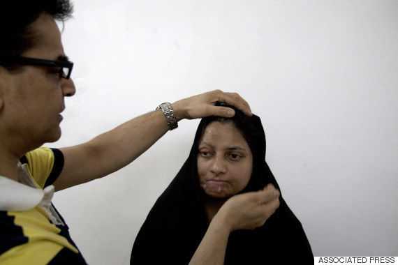 Plastic Surgeon Offers £50,000 Of Surgery To Help Acid Attack Survivors ...