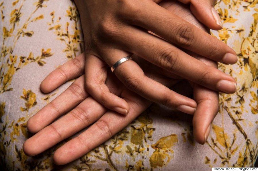 24 Women Bare Their Scars To Reveal The Beauty In Imperfections ...